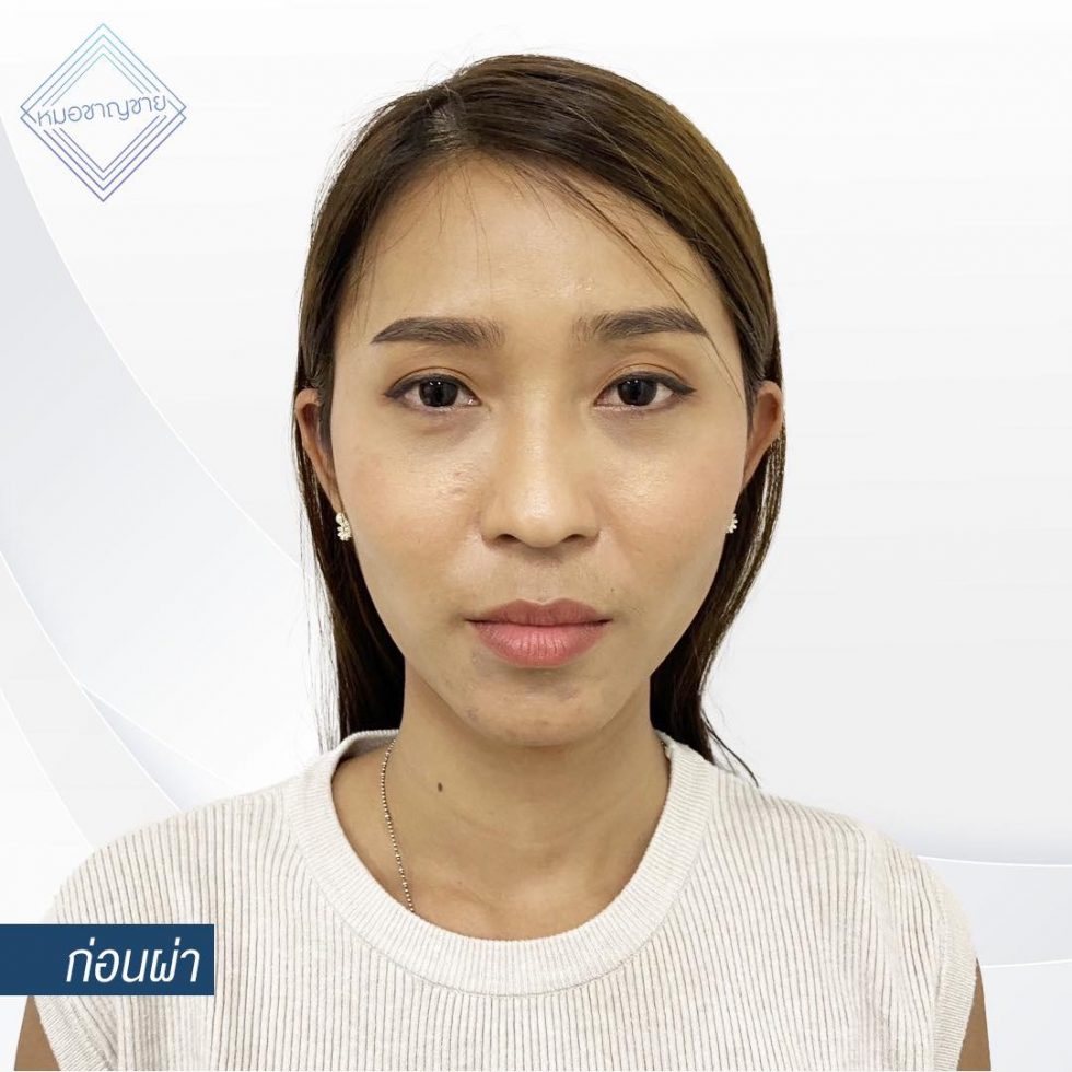 กระชายวัย ละมุนมากเวอร์ - Dr.Chanchai